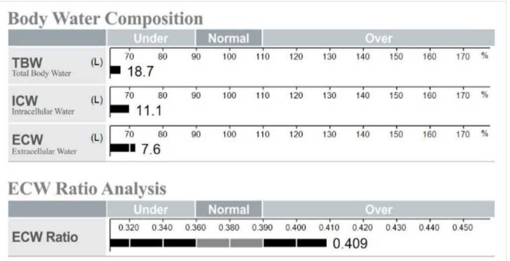 ECW Ratio: Sarcopenia's Unseen Predictor You Need to Know - InBody Asia