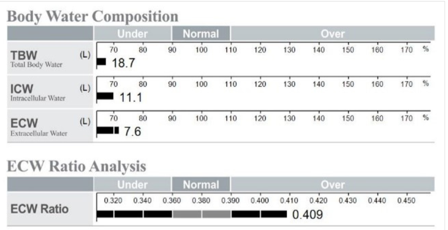 ECW Ratio: Sarcopenia's Unseen Predictor You Need to Know - InBody Asia