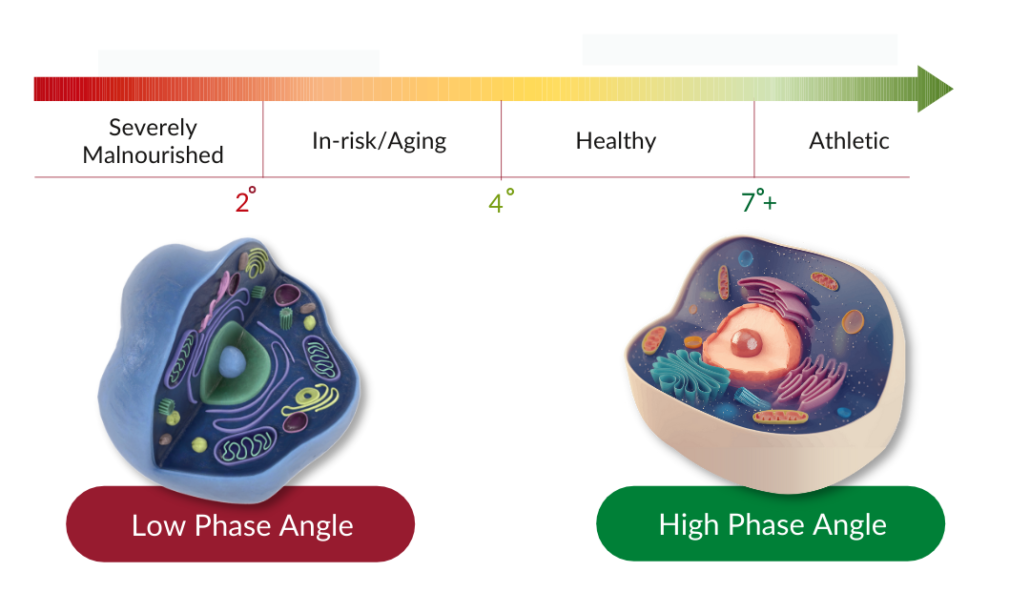 Phase Angle: A New Key for Diabetes Care - InBody Asia